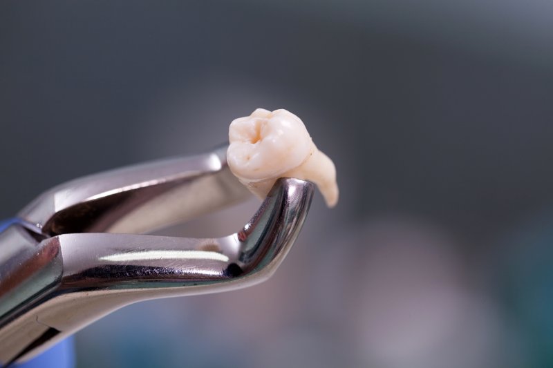 What You Can Expect a Tooth Extraction to Feel Like | HIC Dental ...